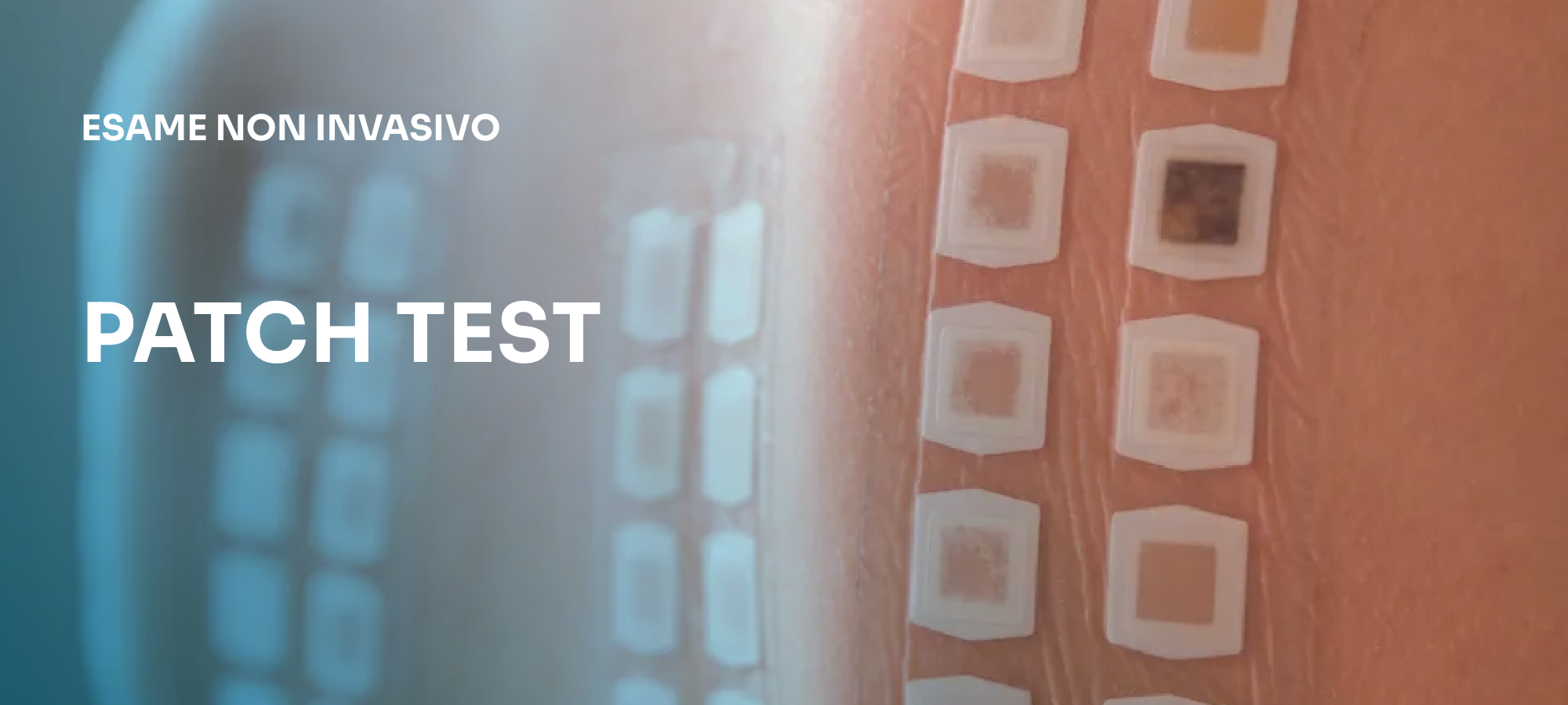 Patch Test - L.C. Laboratori Campisi